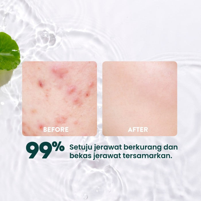 NPURE 30ML Face Toner Centella Asiatica (Cica Series)