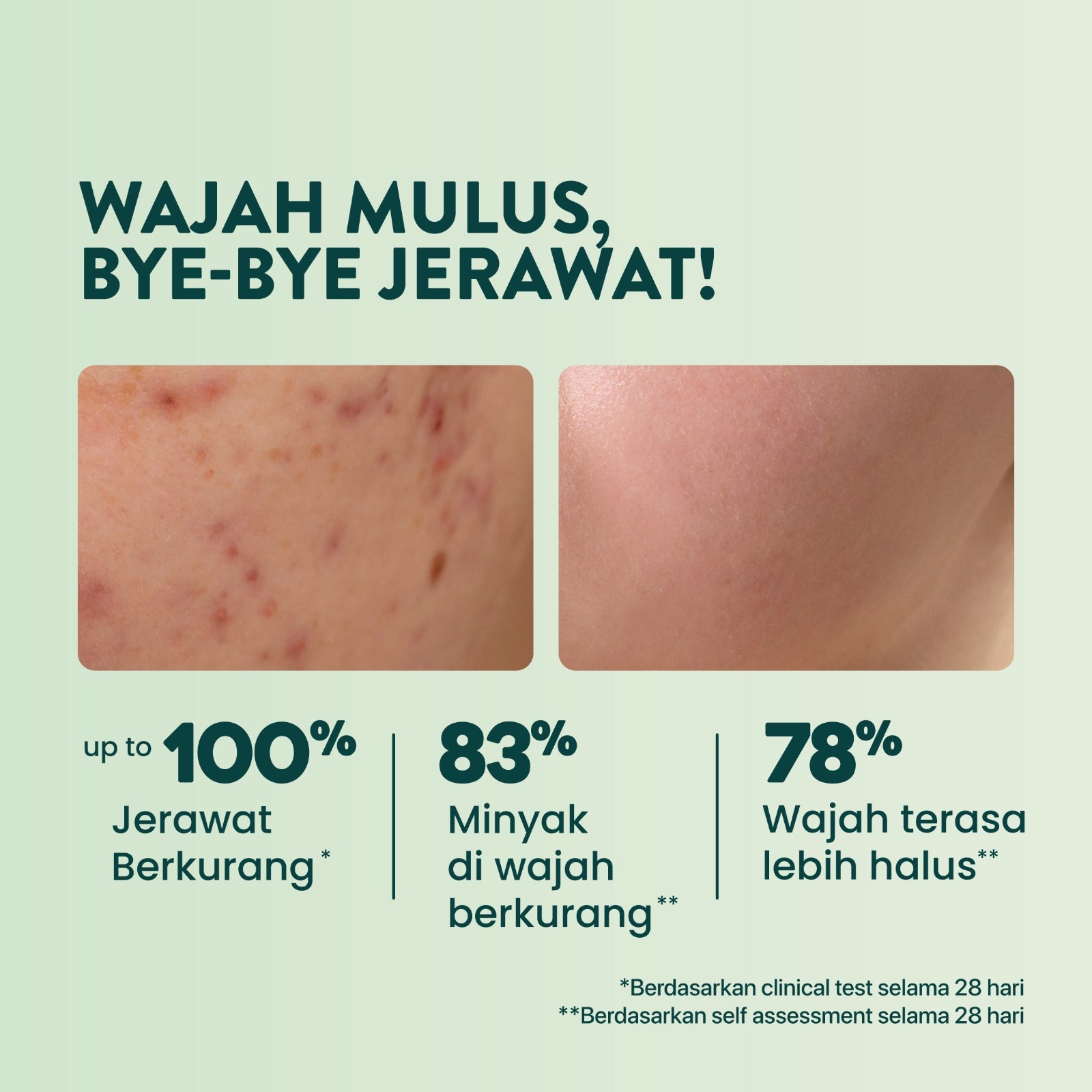 NPURE Anti Acne Biome Serum - Serum Anti Jerawat